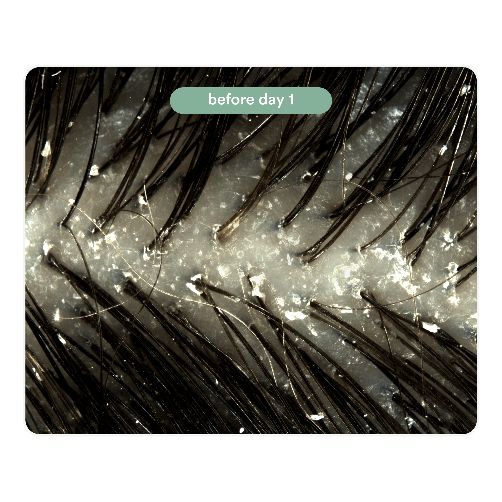 dandruff shampoo | color safe + sulfate free | verb® products