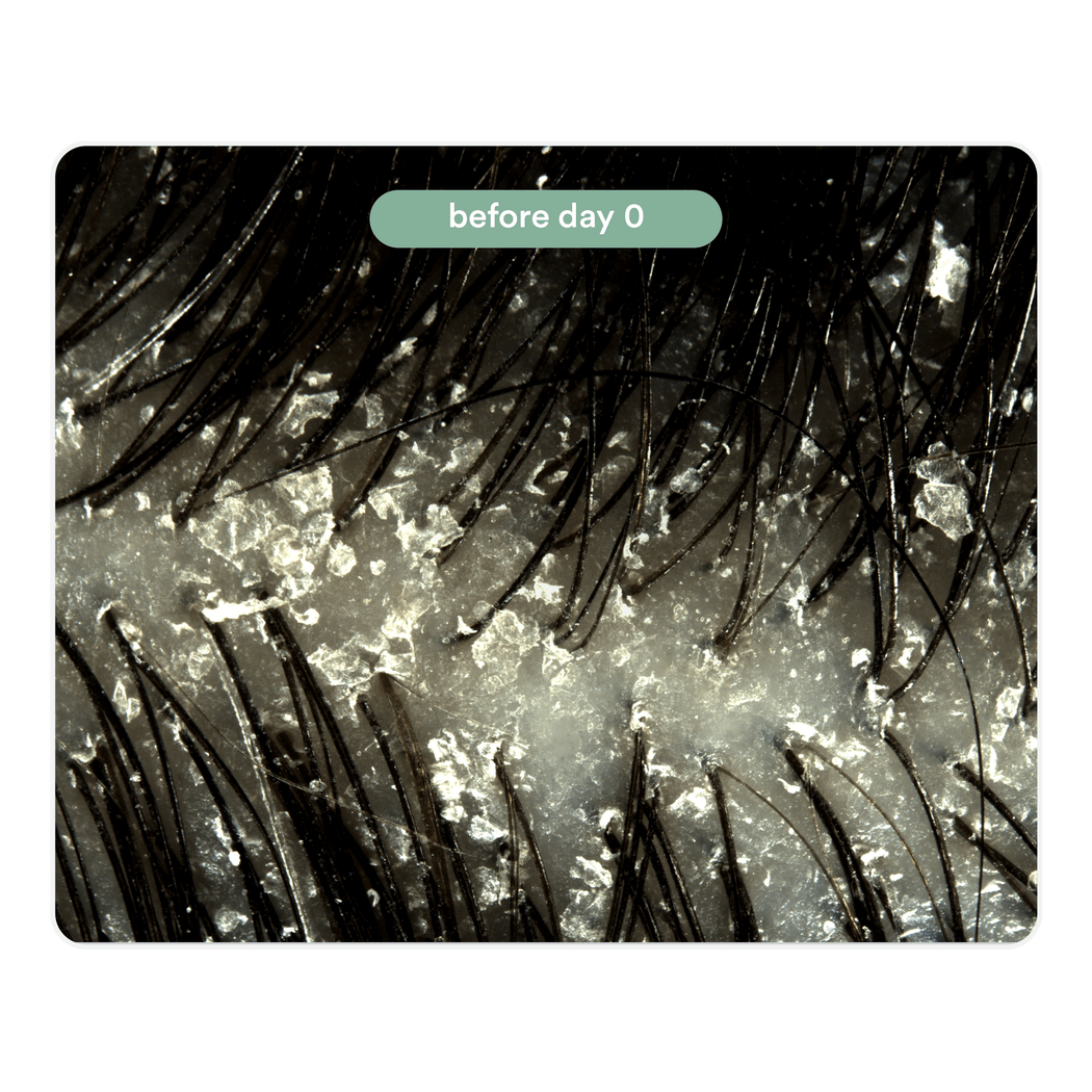 dandruff shampoo | color safe + sulfate free | verb® products