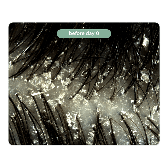 dandruff shampoo | color safe + sulfate free | verb® products