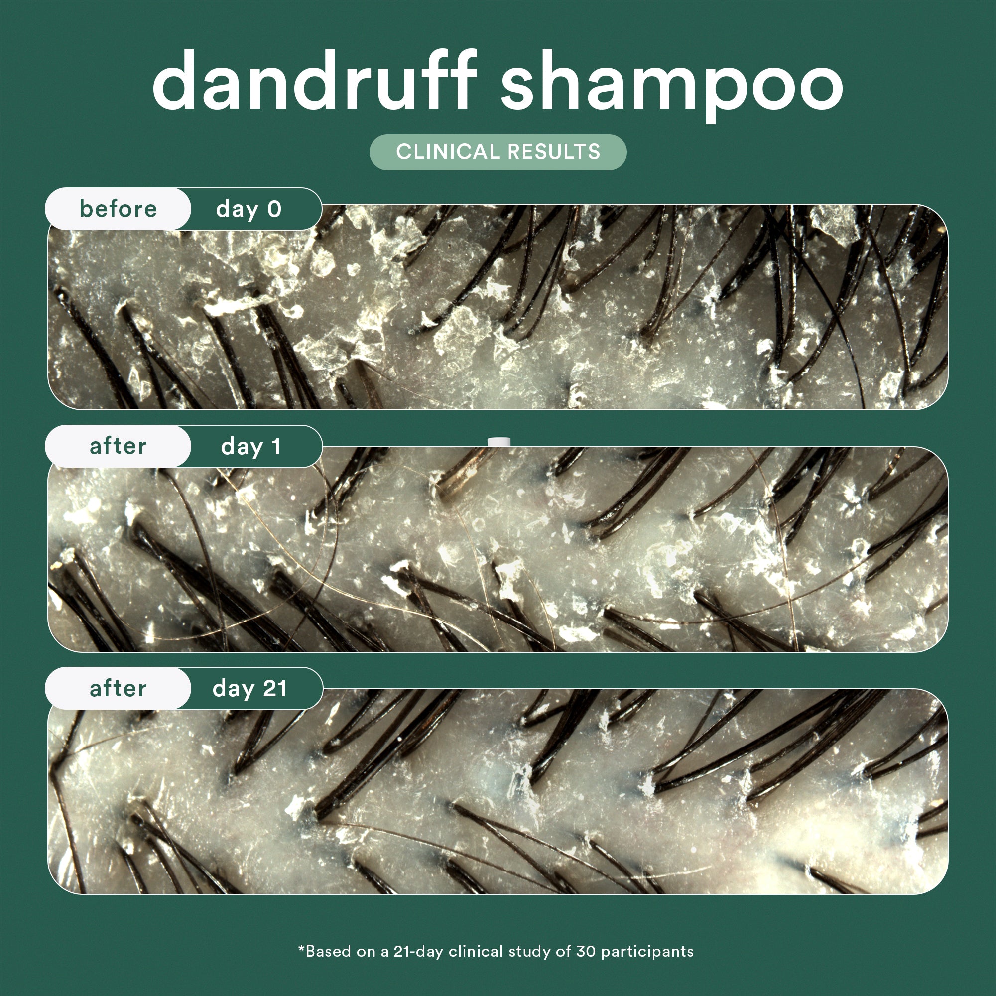 dandruff shampoo | color safe + sulfate free | verb products